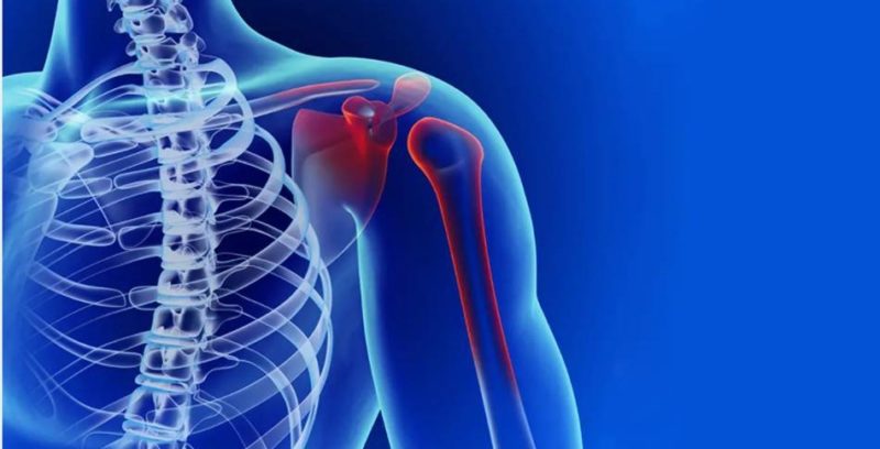 Cuide dos seus ombros e evite dor. Fique atento à lesão do manguito rotador