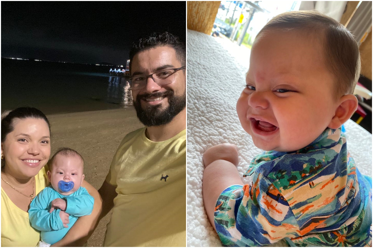 Trigonocefalia RBCP Nautilus: Craniotomia Dinâmica Nova Técnica