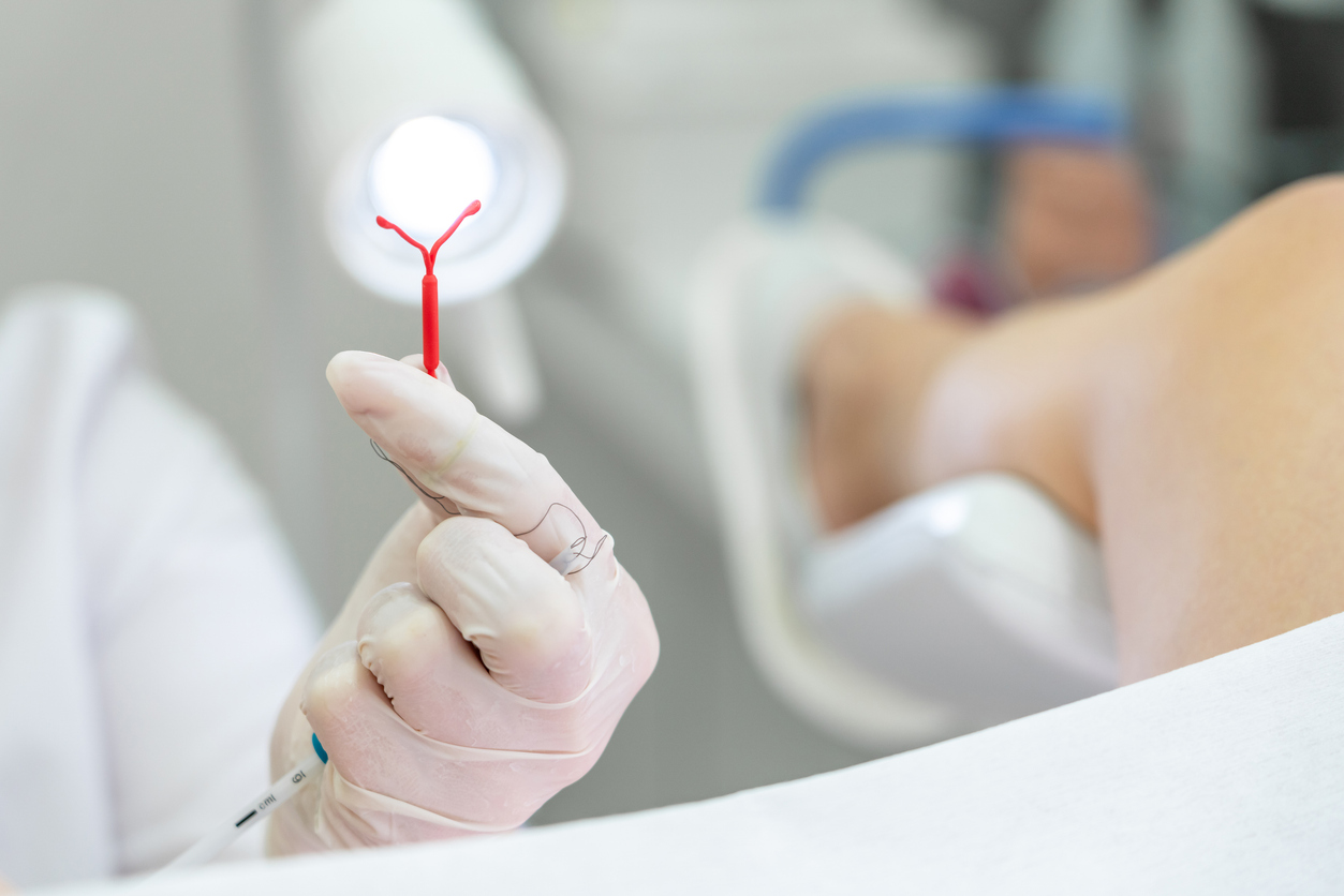 Como funciona o DIU? O que é e como colocar de graça