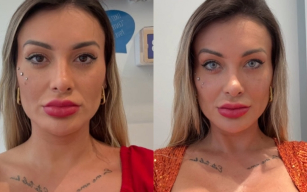 Andressa Urach muda a cor dos olhos para azul e mostra resultado ...