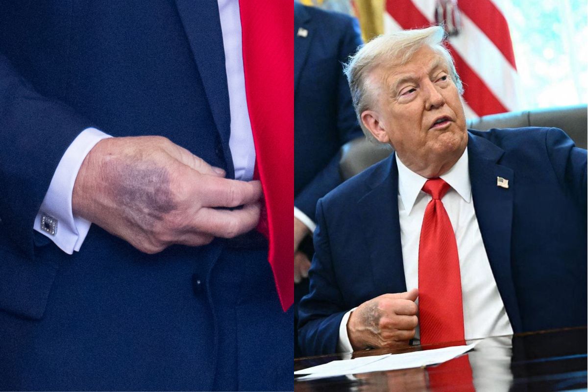 O que está por trás da mão roxa de Trump? Casa Branca explica
