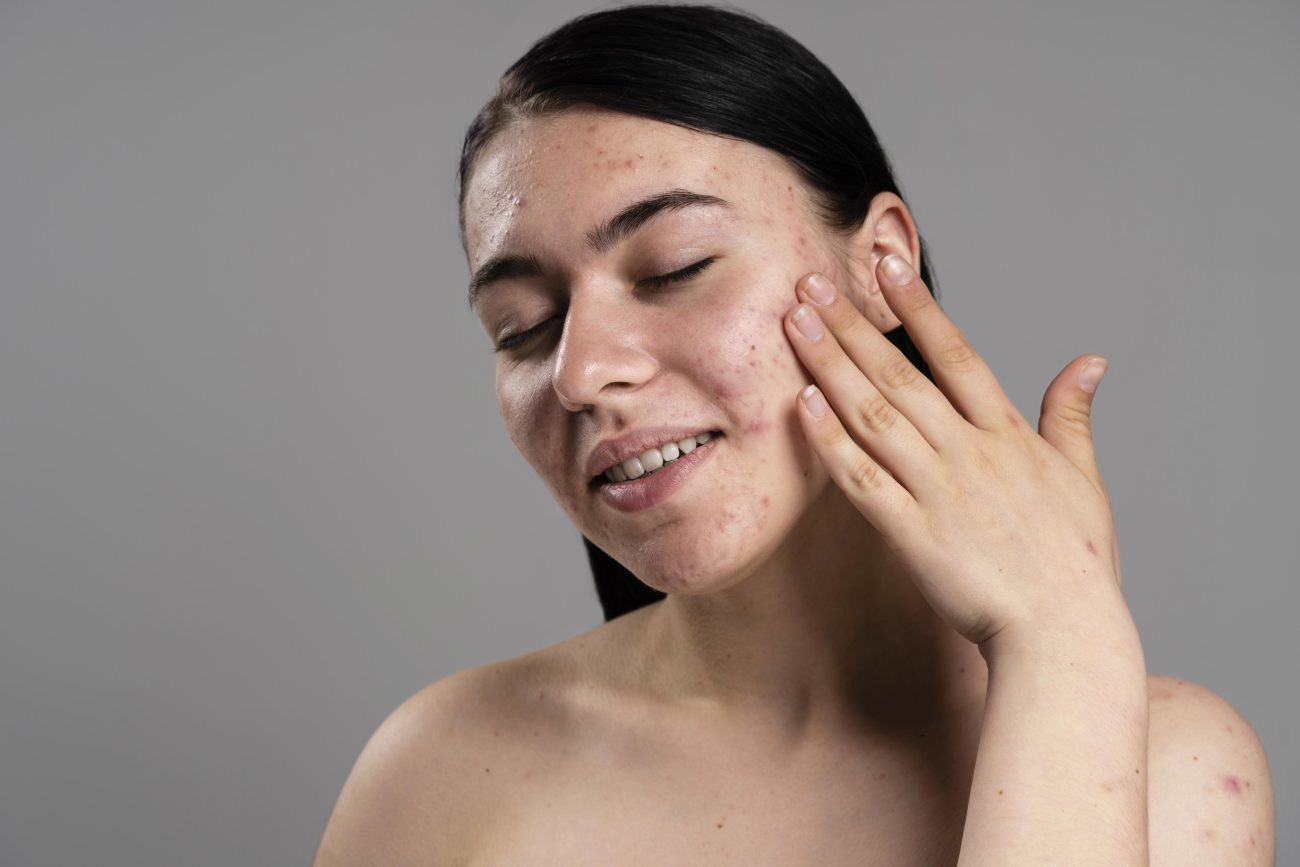 Nivea da lata azul: 3 formas de usar o creme mais famoso do mundo que ...